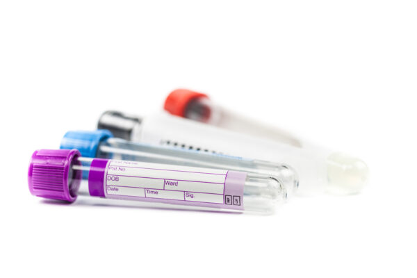 Testing for Lyme Disease • Abounding in Hope with Lyme